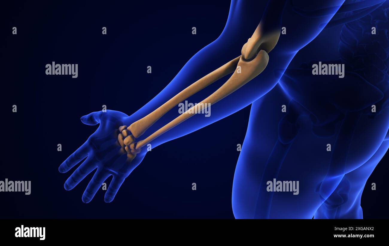 Rib fracture hi-res stock photography and images - Alamy