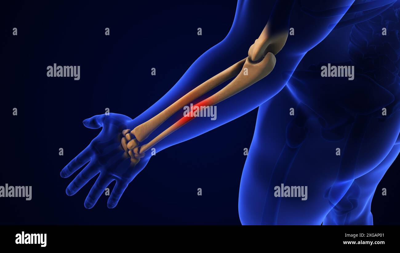 Human ulna arm bone illustration hi-res stock photography and images ...