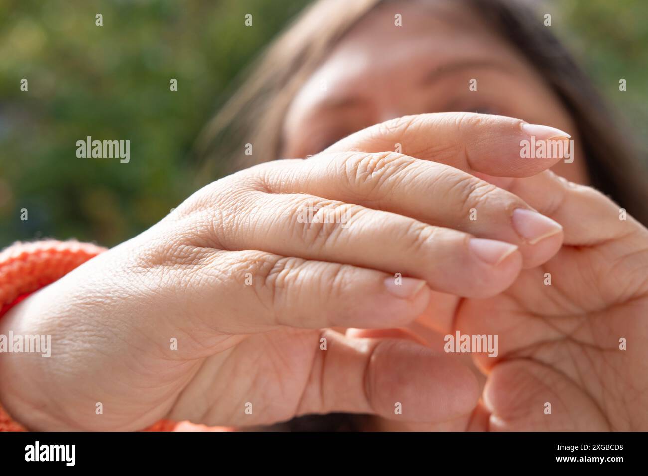 closeup female hands 55 years old with dry skin damage, beauty and ...