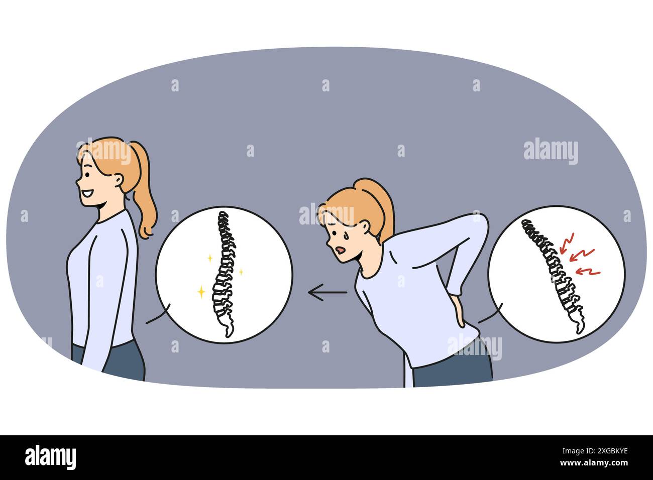 Chiropractic straight posture hi-res stock photography and images - Alamy