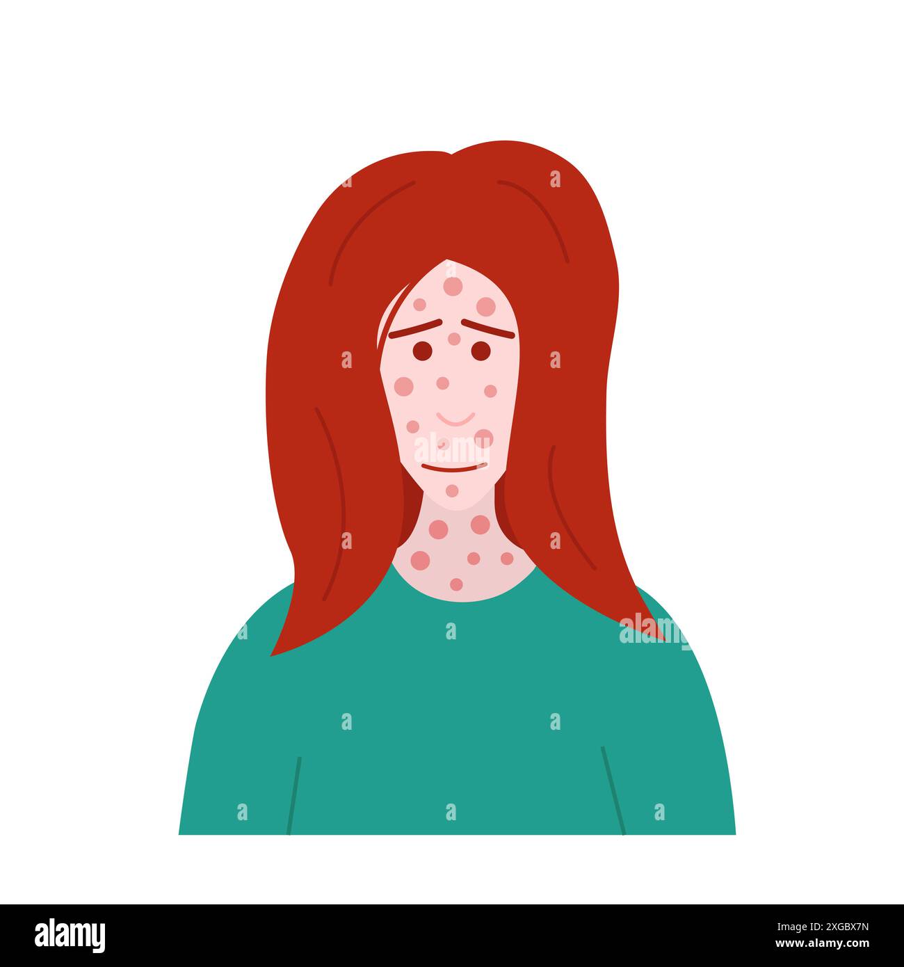 Monkey pox outbreak Stock Vector Image & Art - Alamy