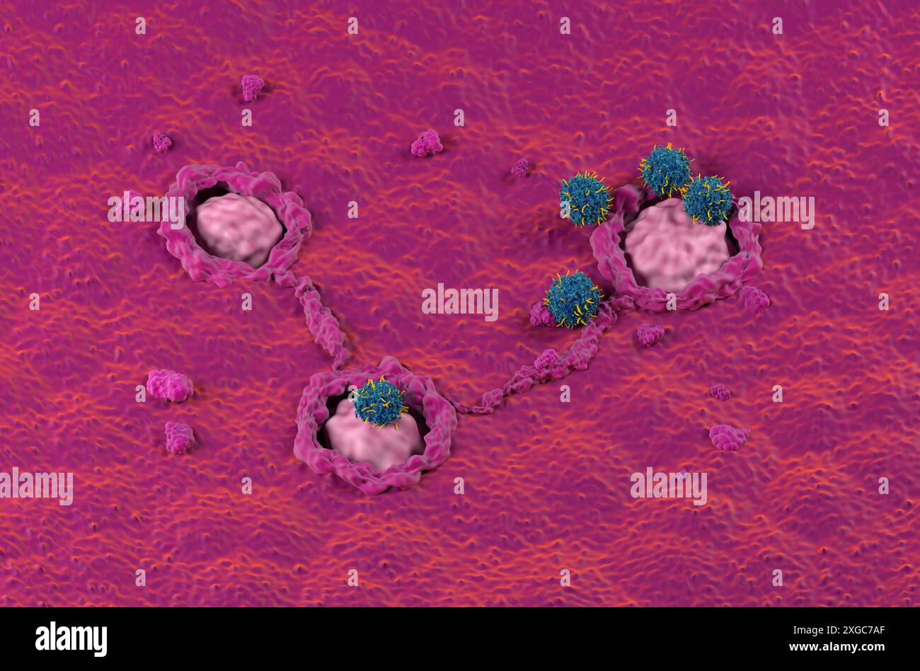 Colonoscopy biopsy gastrointestinal tract in hi-res stock photography ...
