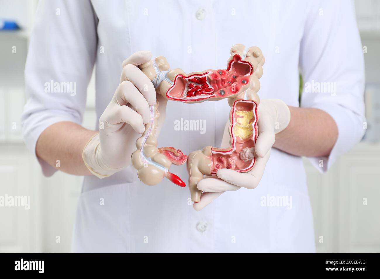 Doctor with model of large intestine in clinic, closeup Stock Photo - Alamy