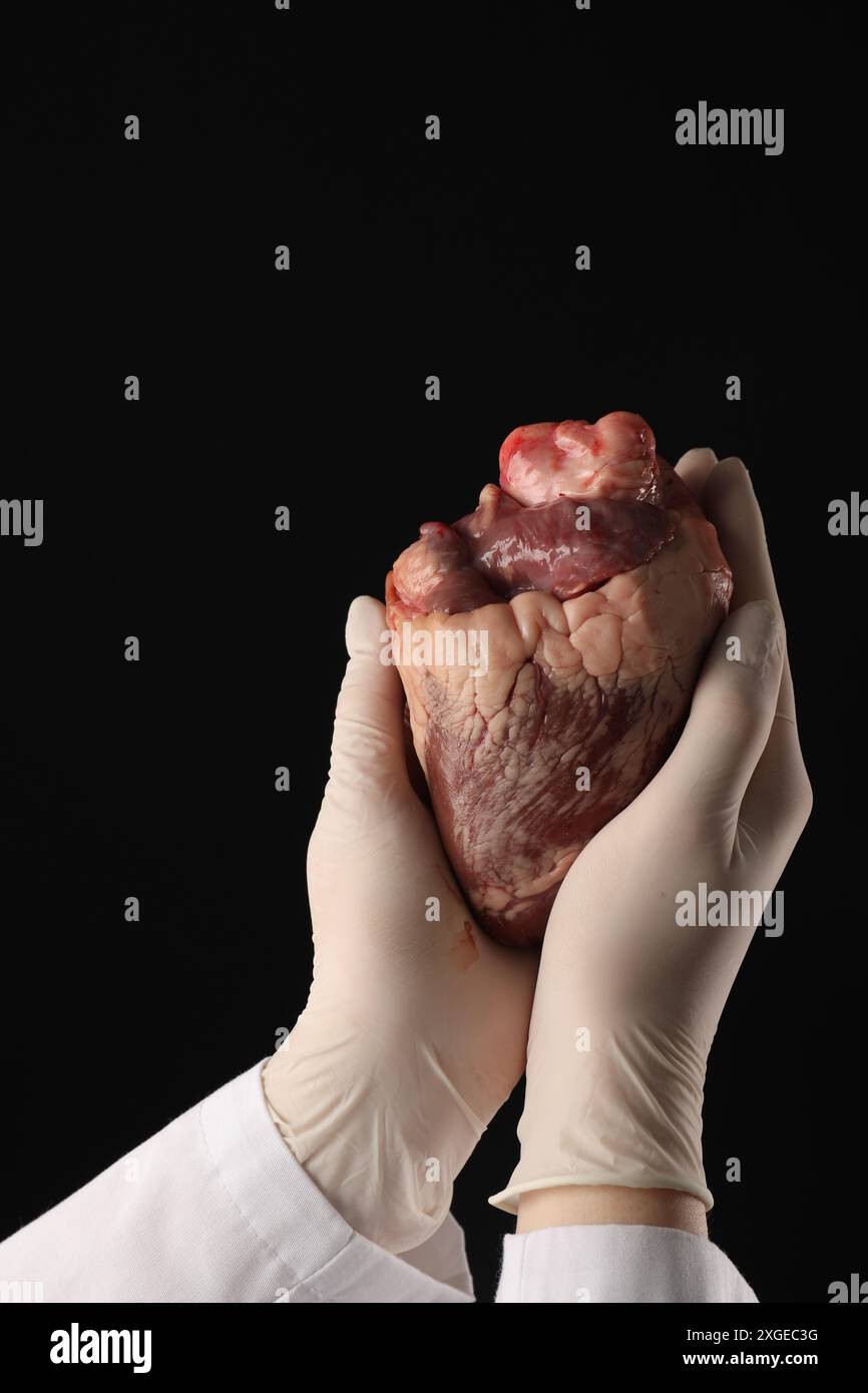 Human heart organ real hi-res stock photography and images - Alamy