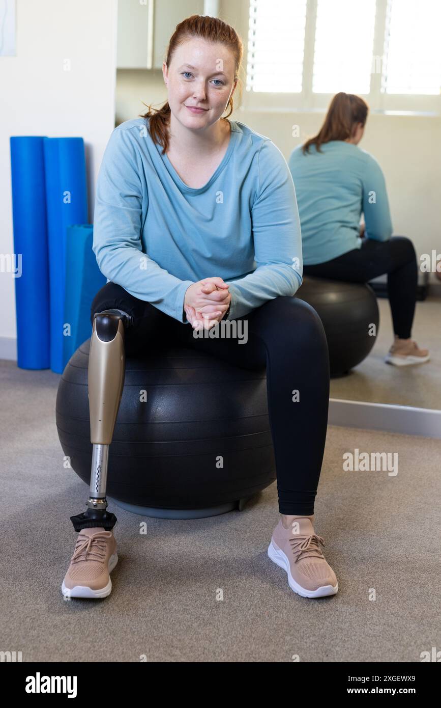 Sitting on exercise ball, woman with prosthetic leg smiling in gym ...