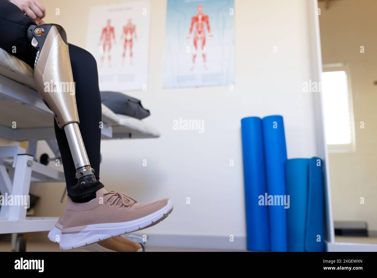 Person with prosthetic leg sitting on medical examination table in ...