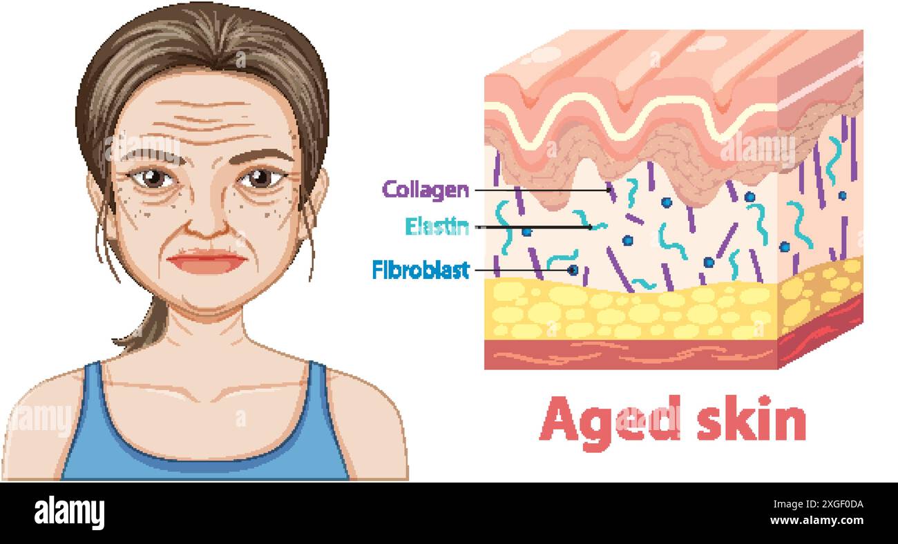 Illustration showing aged skin structure and components Stock Vector ... Illustration showing aged skin structure and components Stock Vector ...