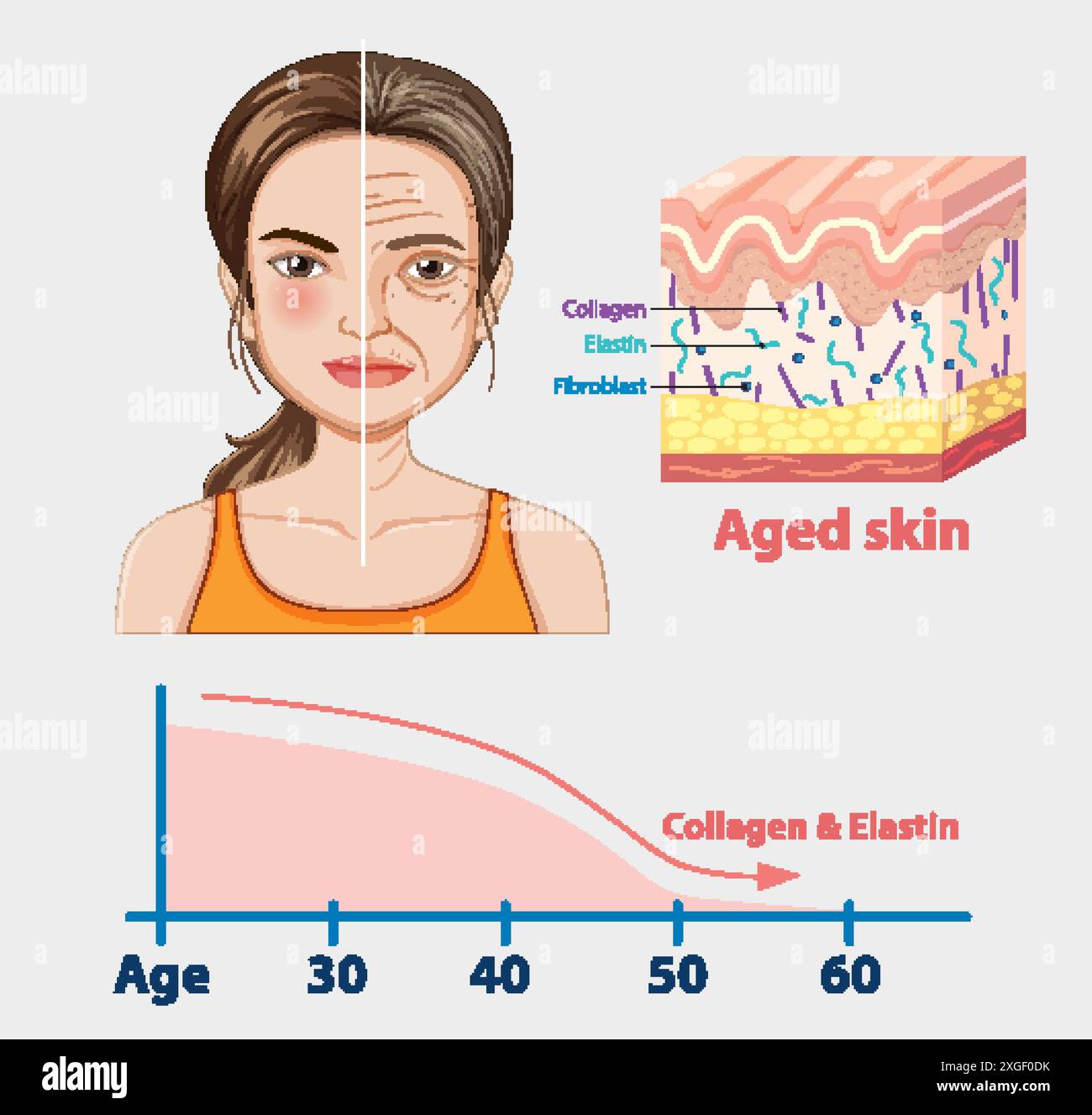 Illustration of skin aging and collagen reduction Stock Vector Image ...