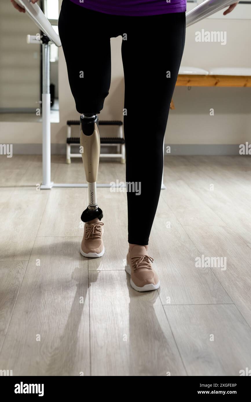 Walking with prosthetic leg, person practicing in rehabilitation center ...