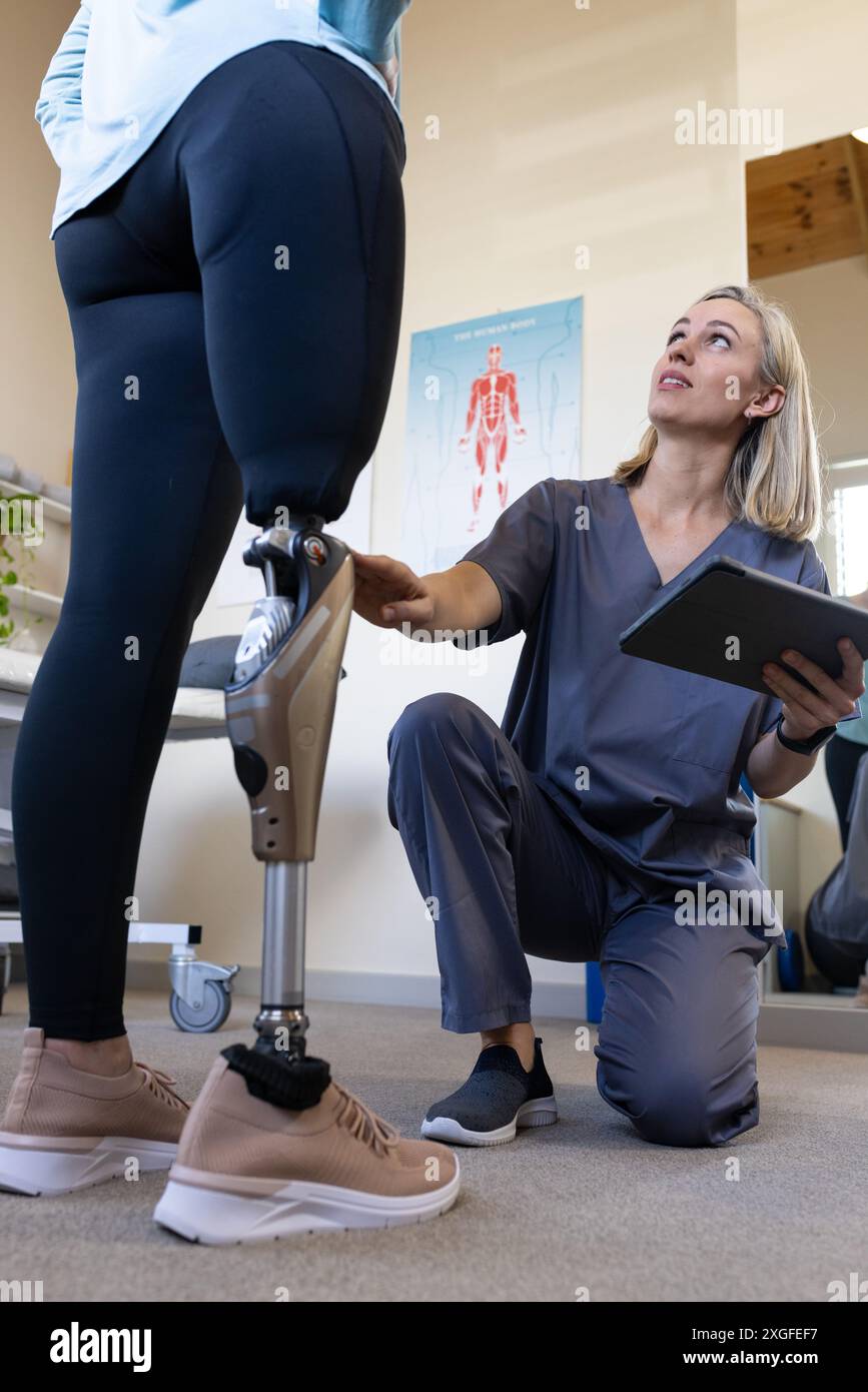 Therapist examining prosthetic leg while holding tablet in ...