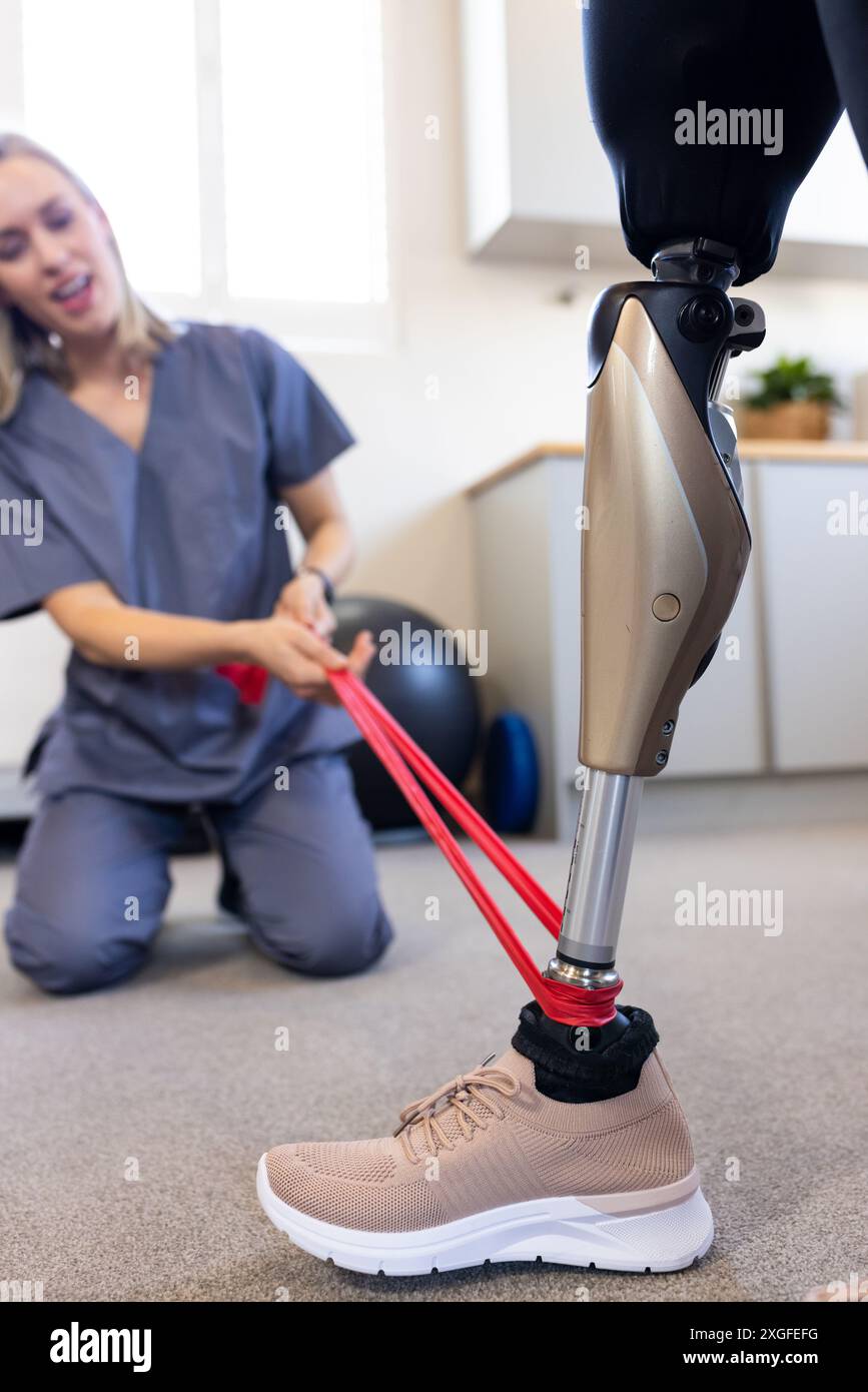 Physical therapist assisting patient with prosthetic leg using ...