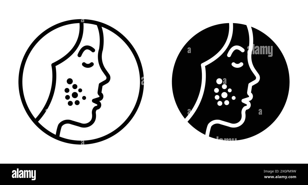 Acne treatment cream vector hi-res stock photography and images - Alamy