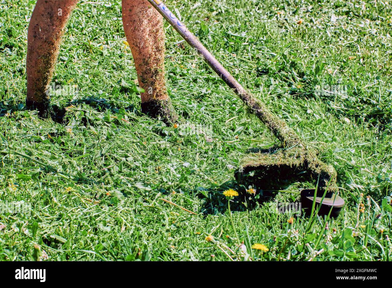 Groundskeeper uses string weed trimmer without protecting his skin with ...