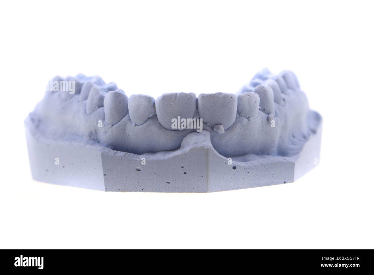 teeth gypsum model isolated on the white background Stock Photo - Alamy