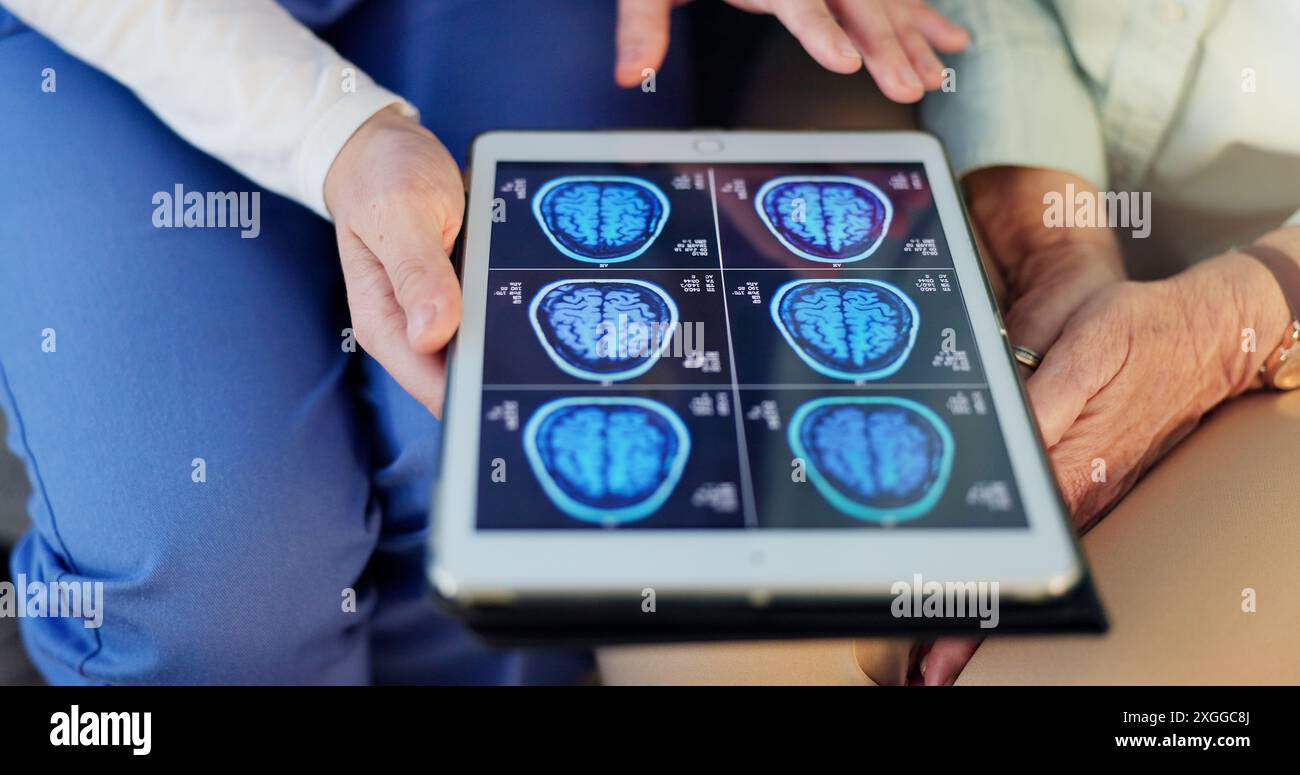 Hands, doctor and patient with tablet, brain scan and healthcare with ...