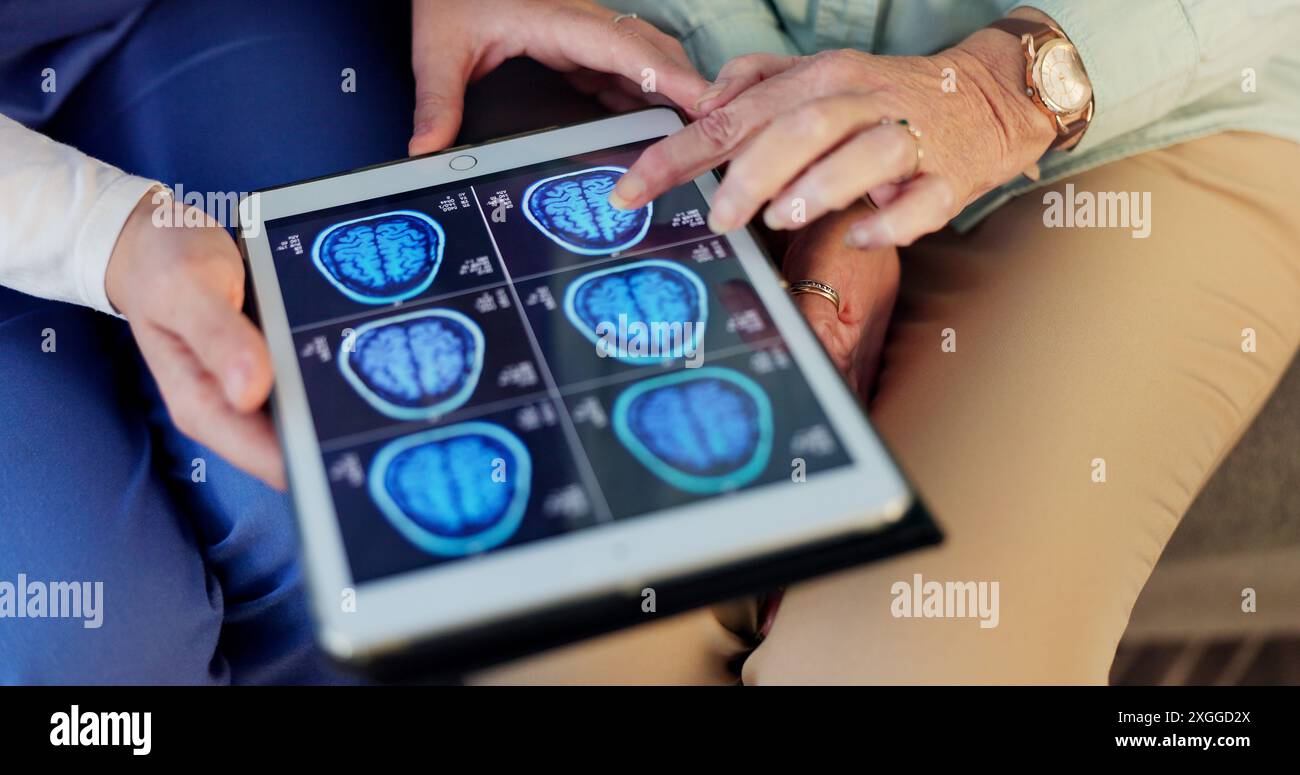 Hands, nurse and patient with tablet, brain scan and healthcare with ...
