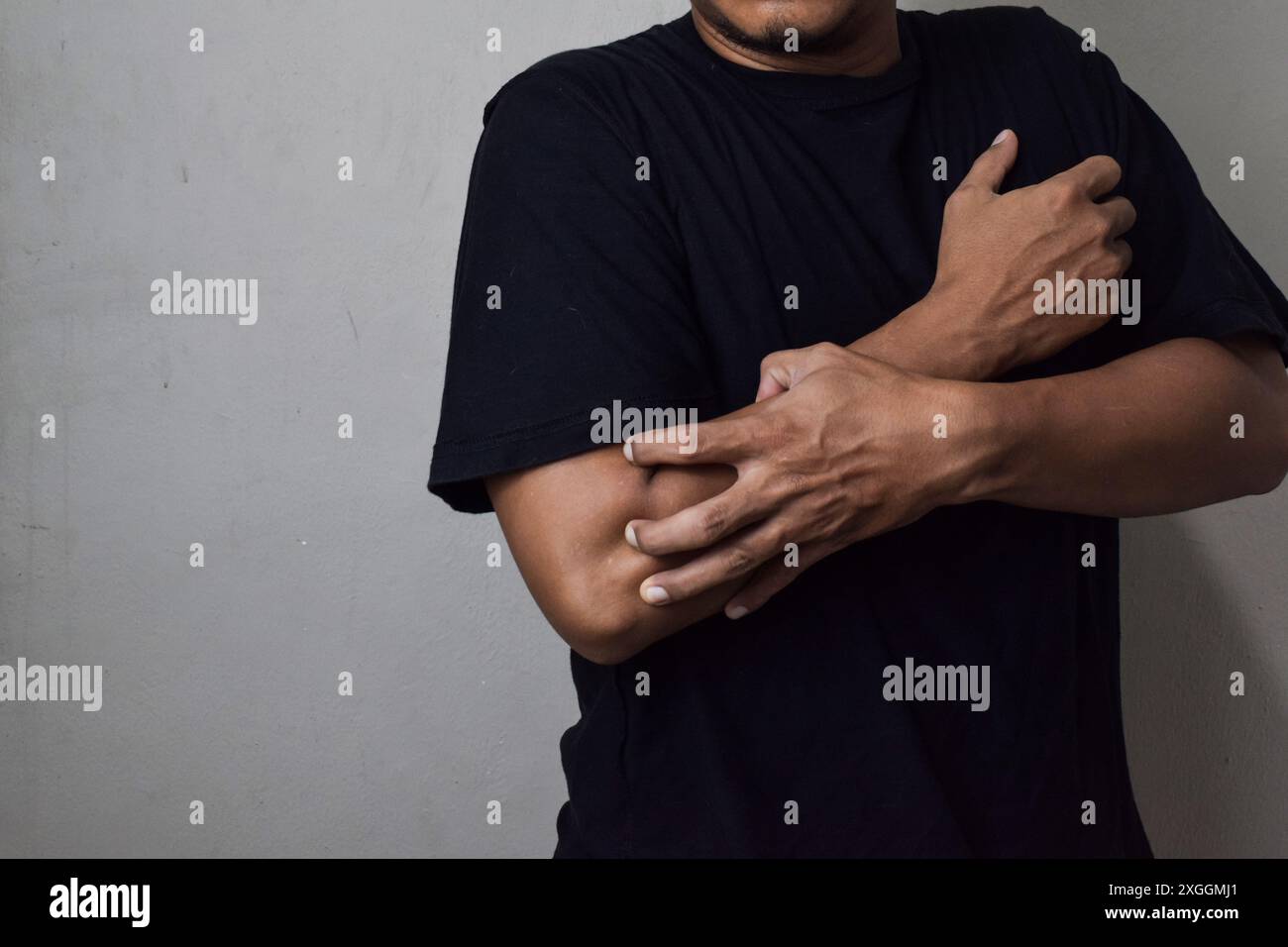 View of man scratching hand with allergy isolated on beige background ...