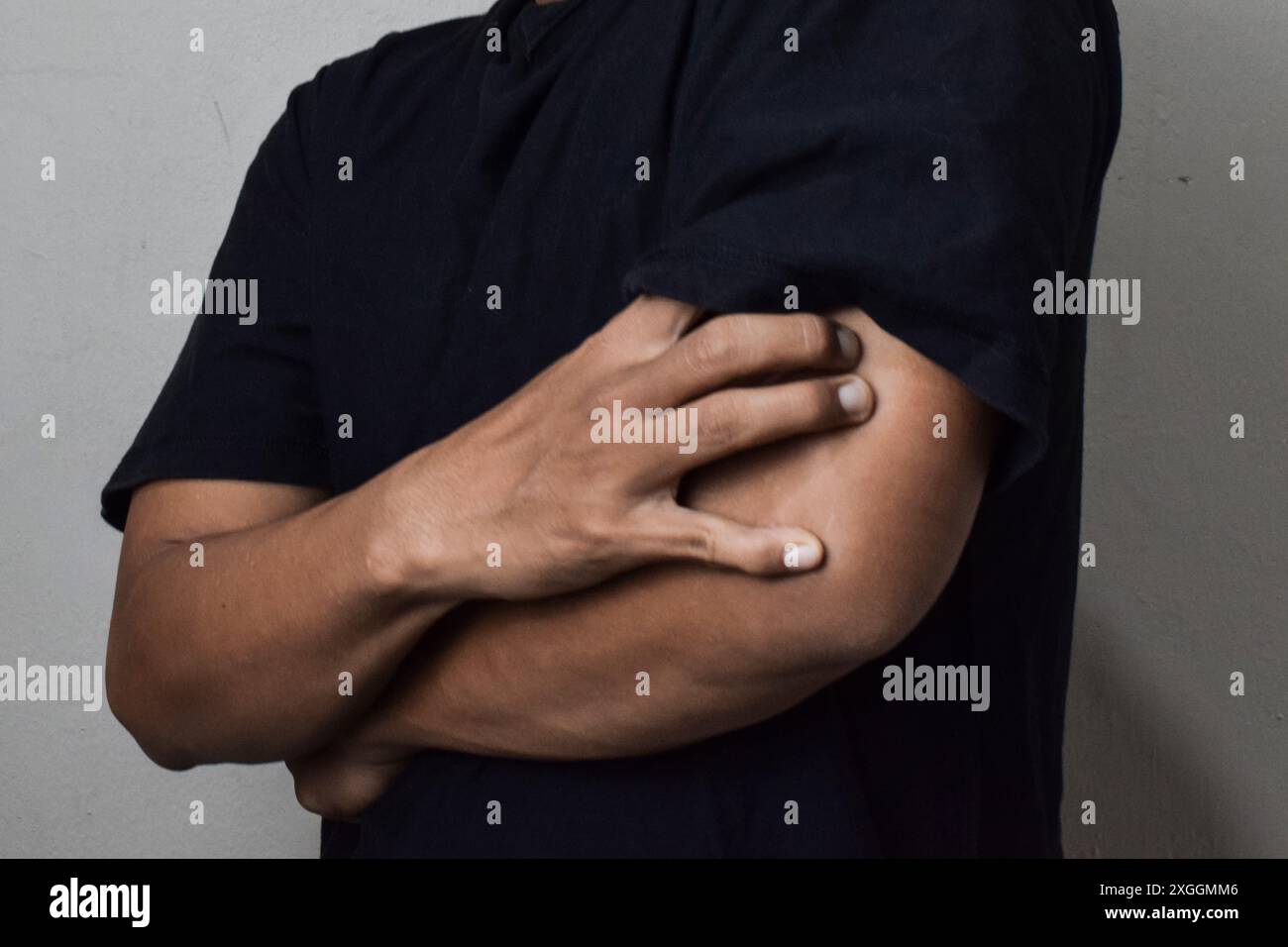 View of man scratching hand with allergy isolated on beige background ...
