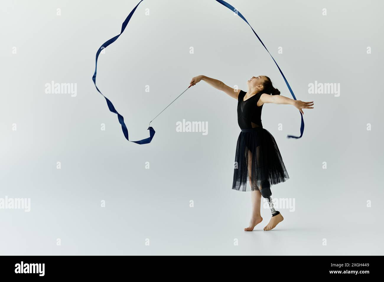 A young girl with a prosthetic leg performs rhythmic gymnastics with a ...