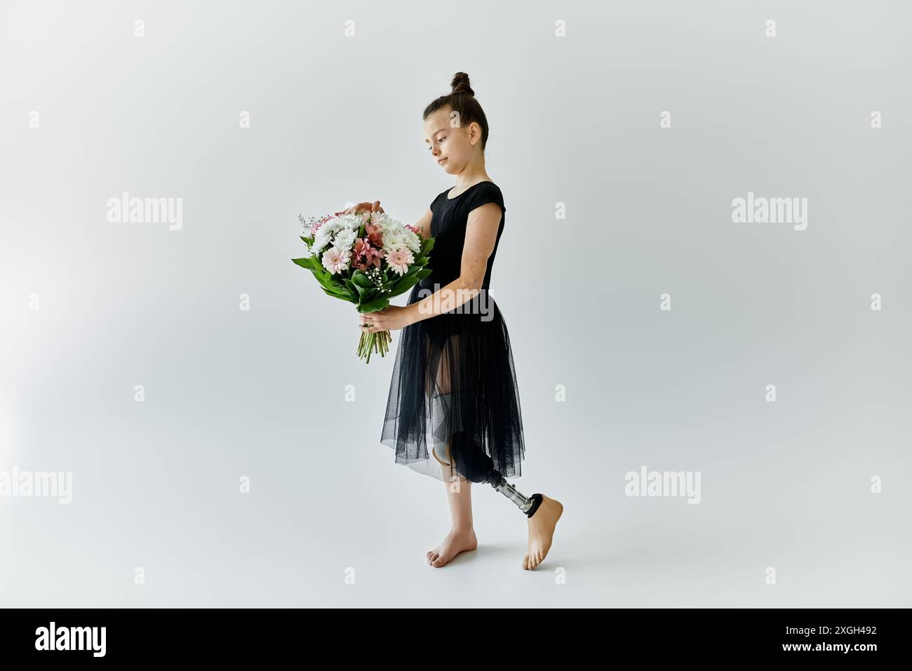 A young gymnast with a prosthetic leg poses gracefully while holding a ...