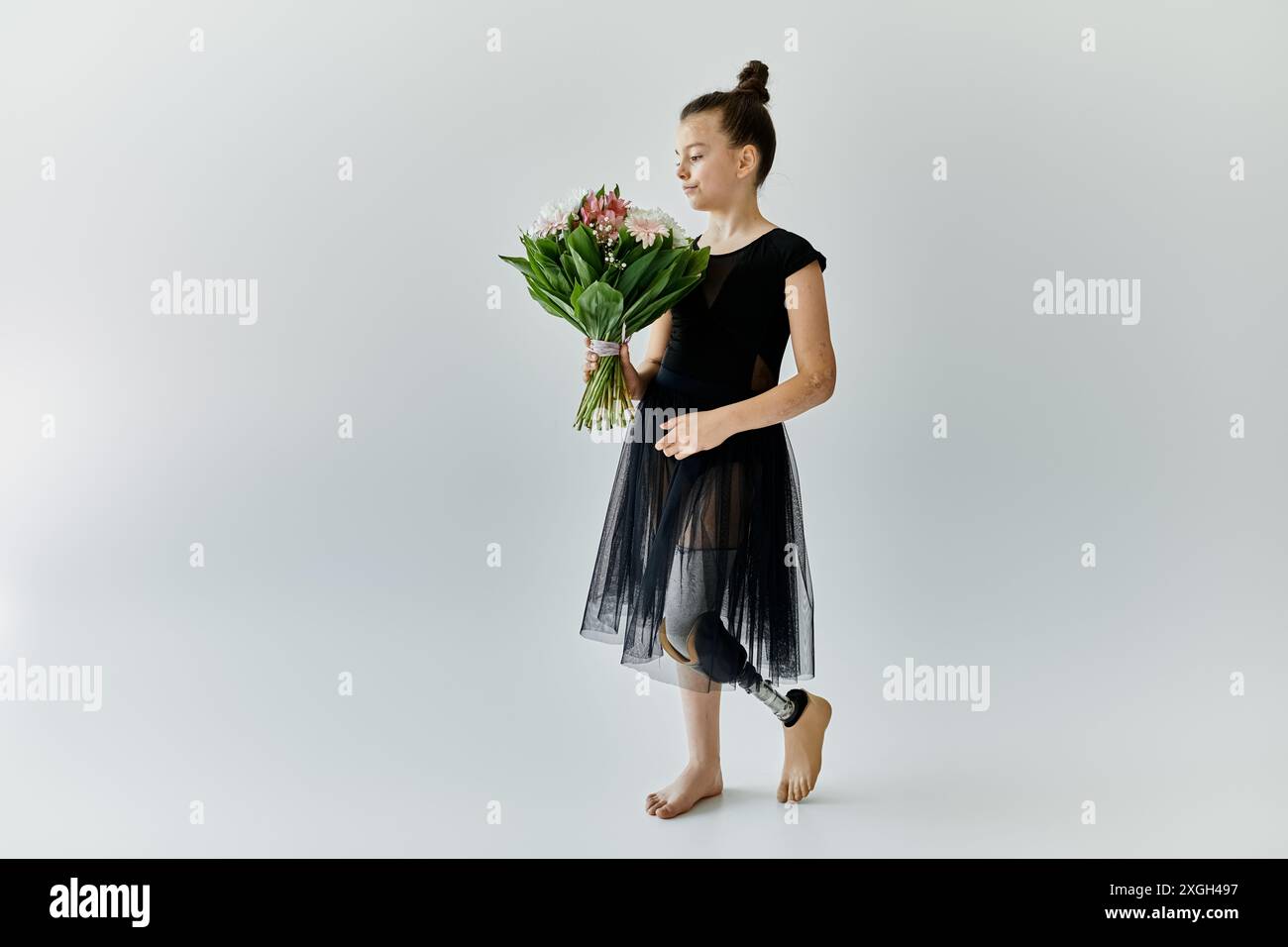 A young girl with a prosthetic leg holds a bouquet of flowers in a ...