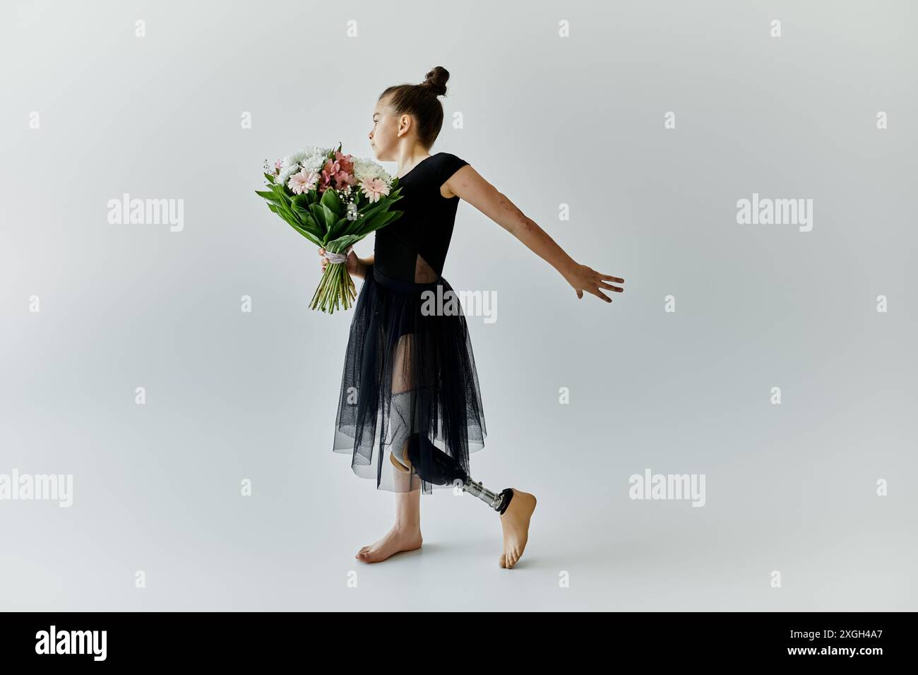A young girl with a prosthetic leg performs a gymnastic pose while ...