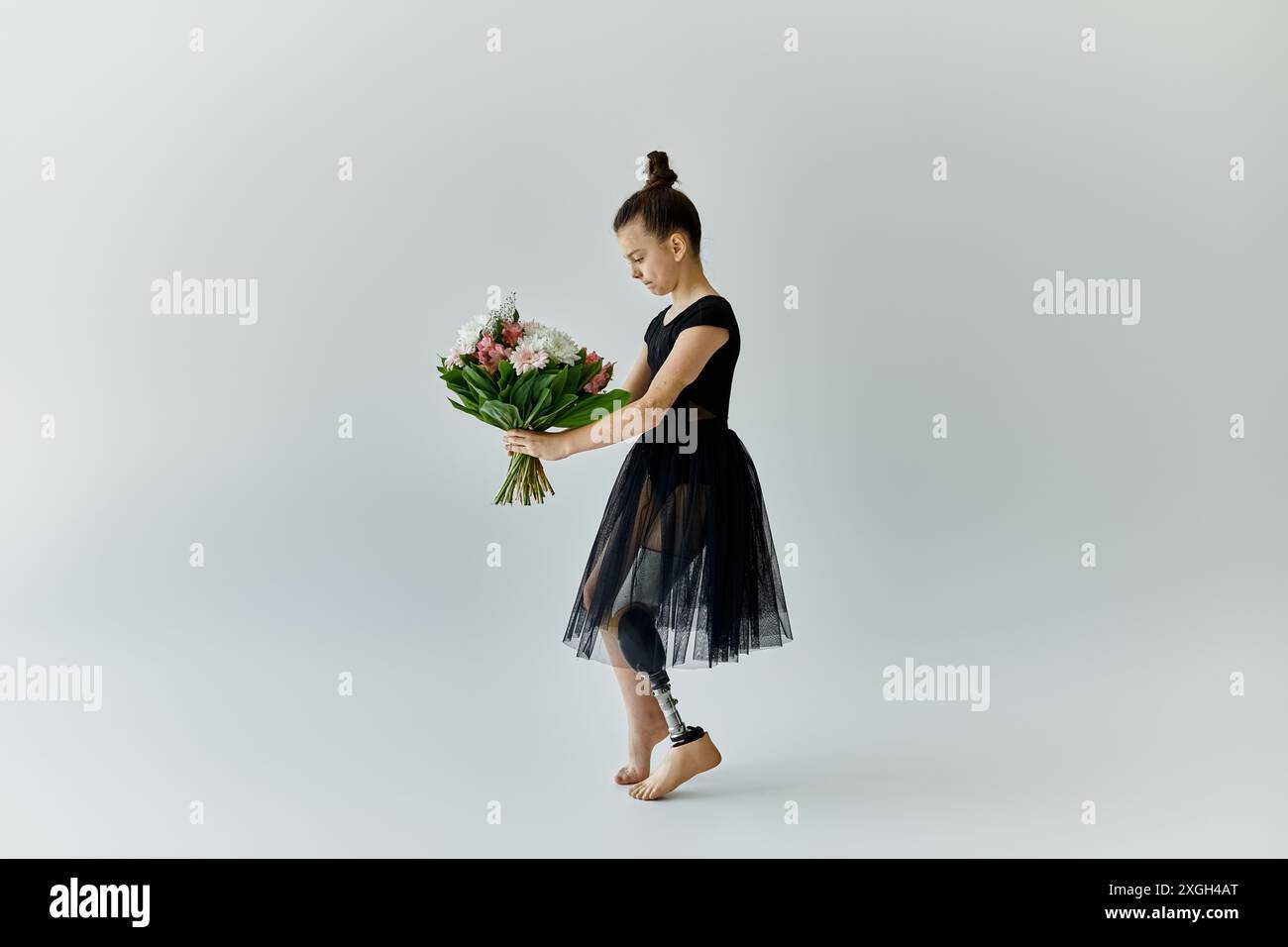 A young girl with a prosthetic leg holds a bouquet of flowers while ...