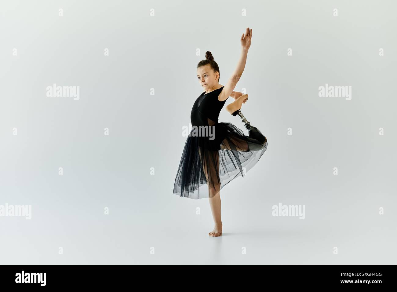 A young girl with a prosthetic leg performs a graceful ballet pose ...