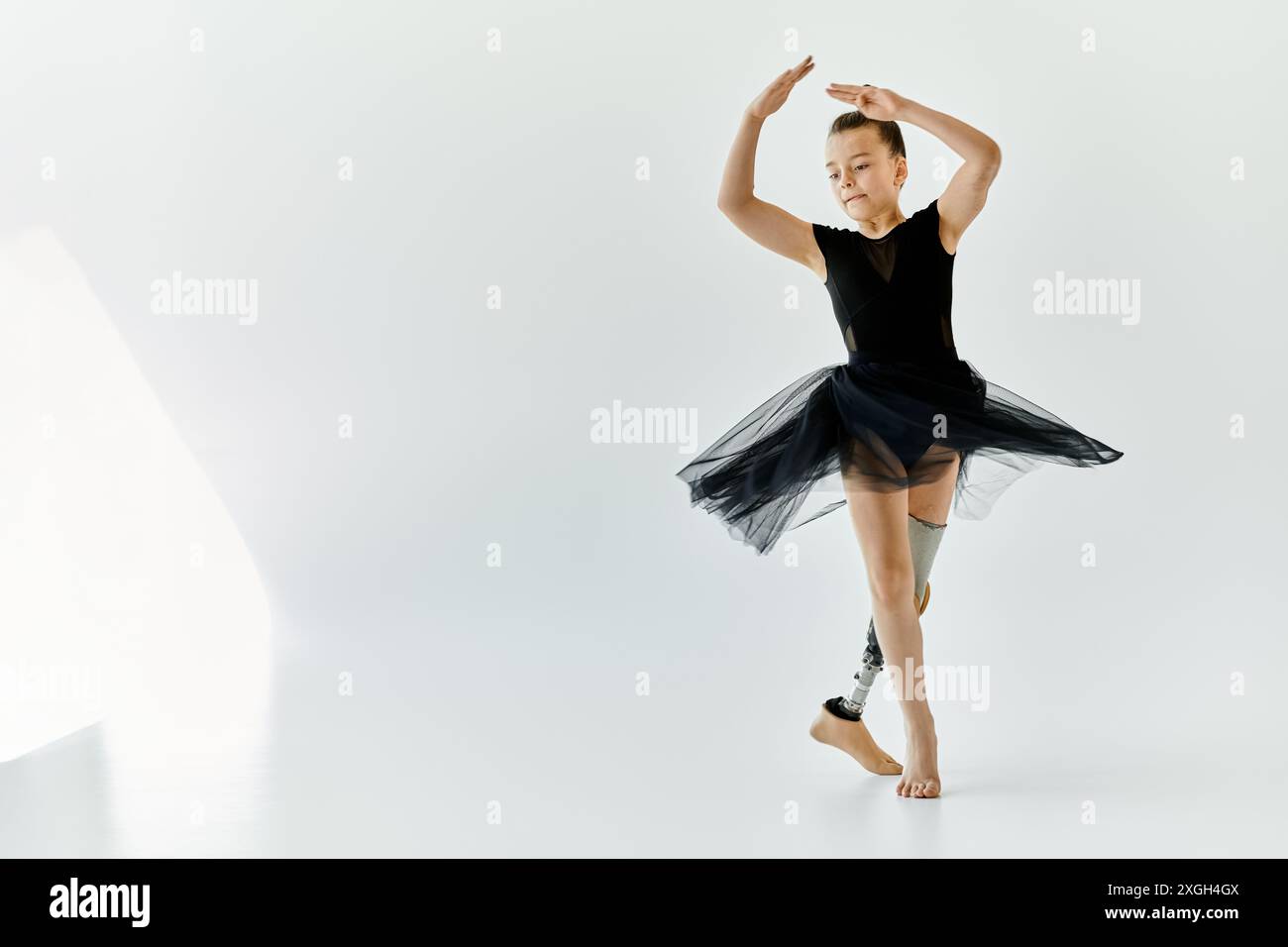 A young girl with a prosthetic leg performs a graceful ballet pose in a ...