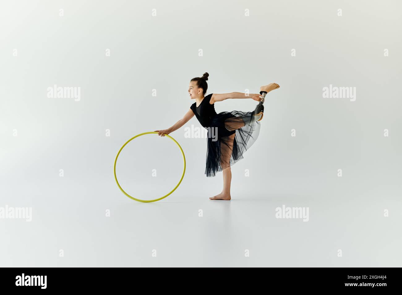 A young girl with a prosthetic leg practices gymnastics with a hula ...
