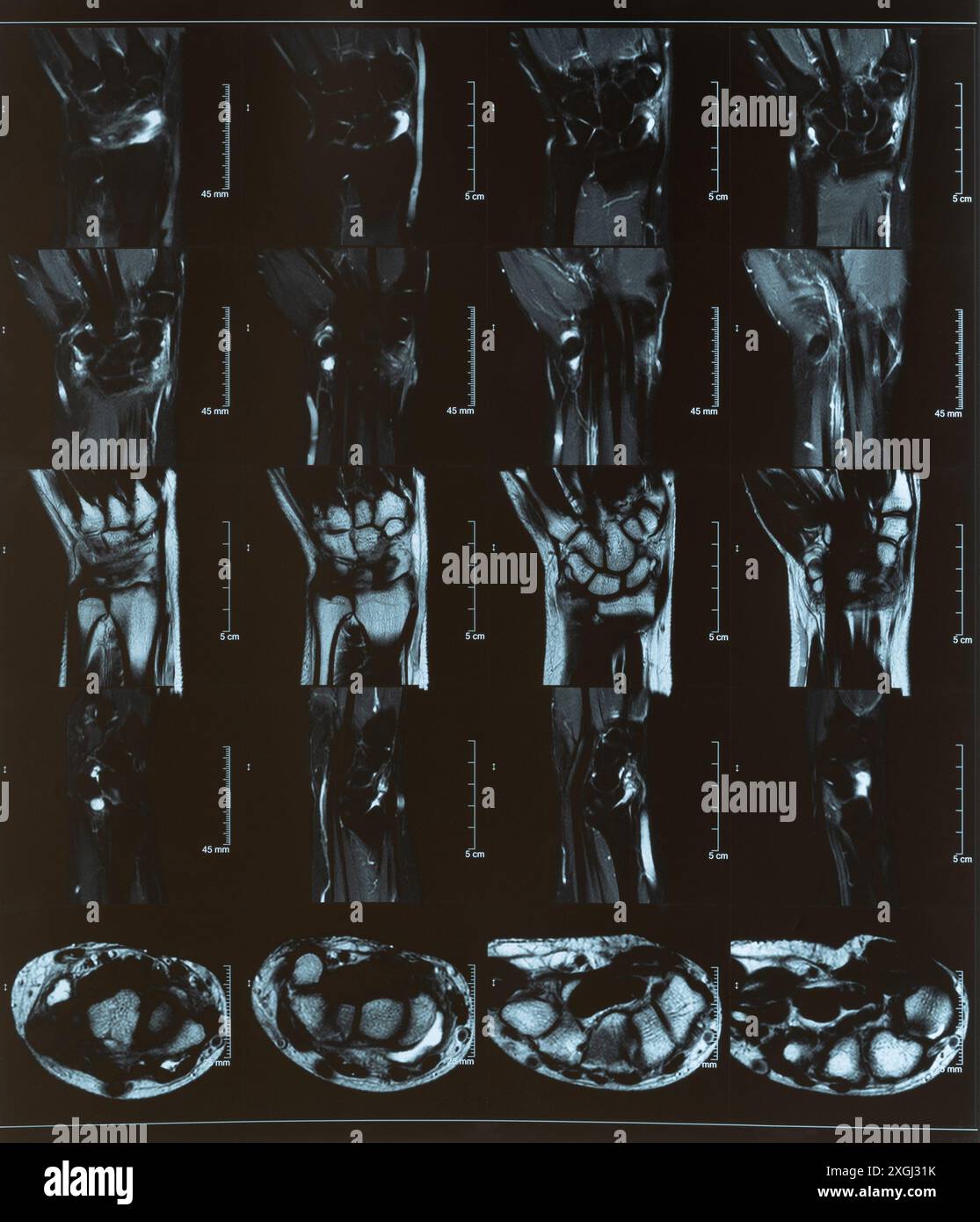 Science medical x ray of hand hi-res stock photography and images - Alamy