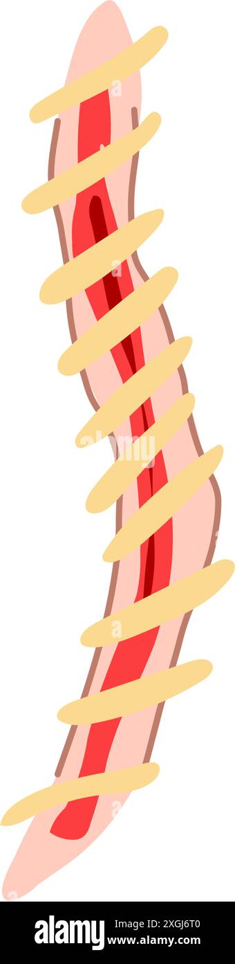 surgical suture cartoon vector illustration Stock Vector Image & Art ...