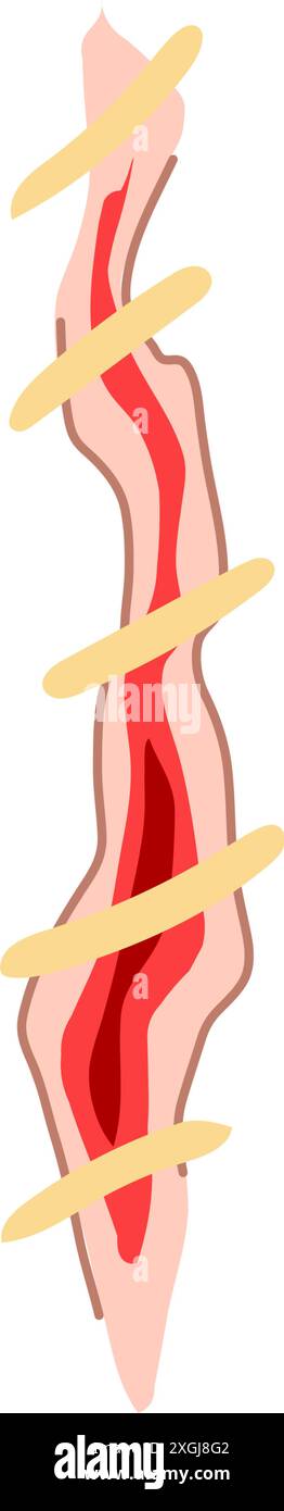 surgery suture cartoon vector illustration Stock Vector Image & Art - Alamy