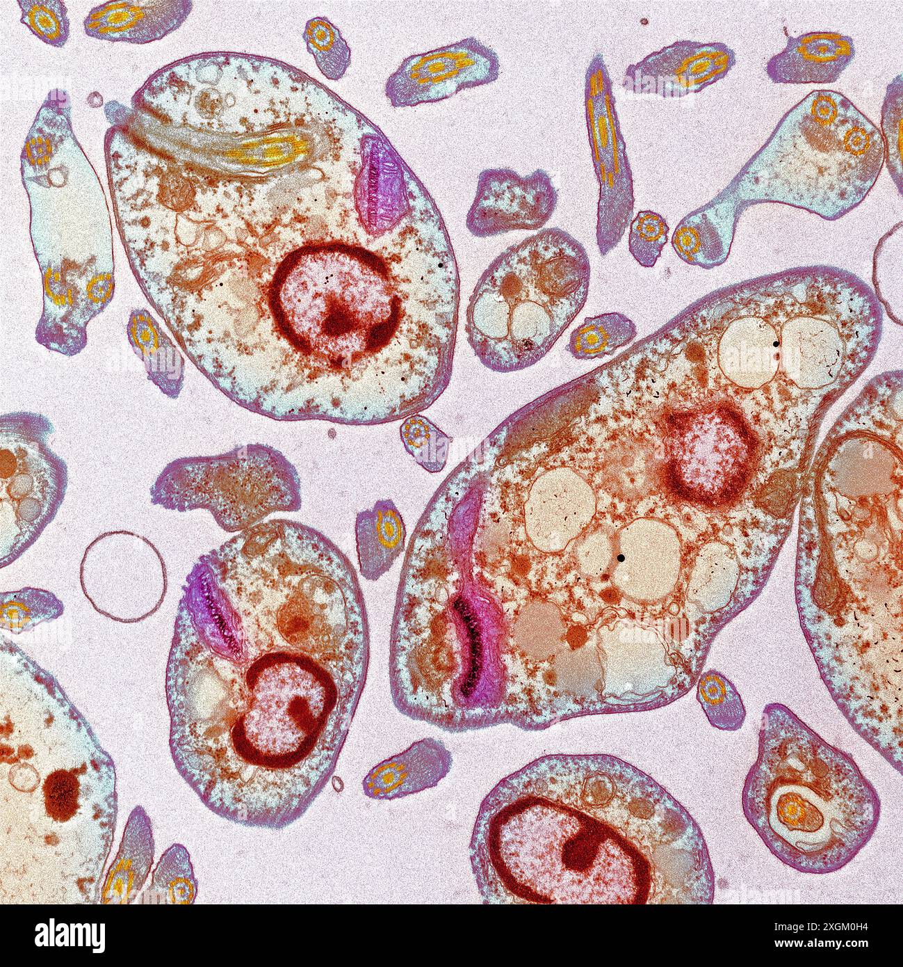 Coloured transmission electron micrograph (TEM) of Leishmania major ...