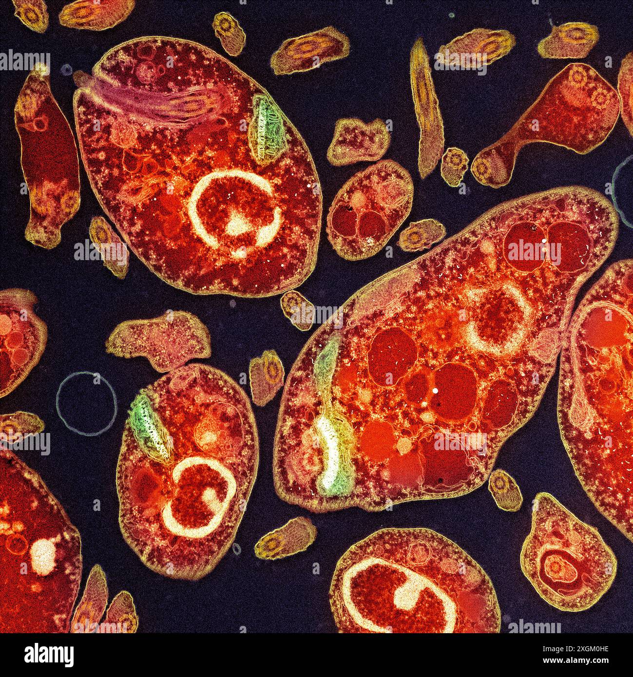 Coloured transmission electron micrograph (TEM) of Leishmania major ...
