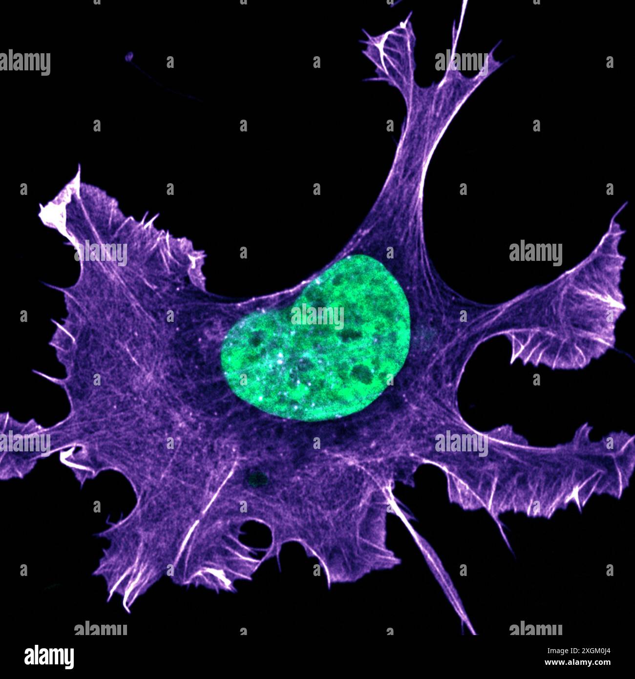 Migrating Ewing sarcoma cancer cell, confocal light micrograph. A ...