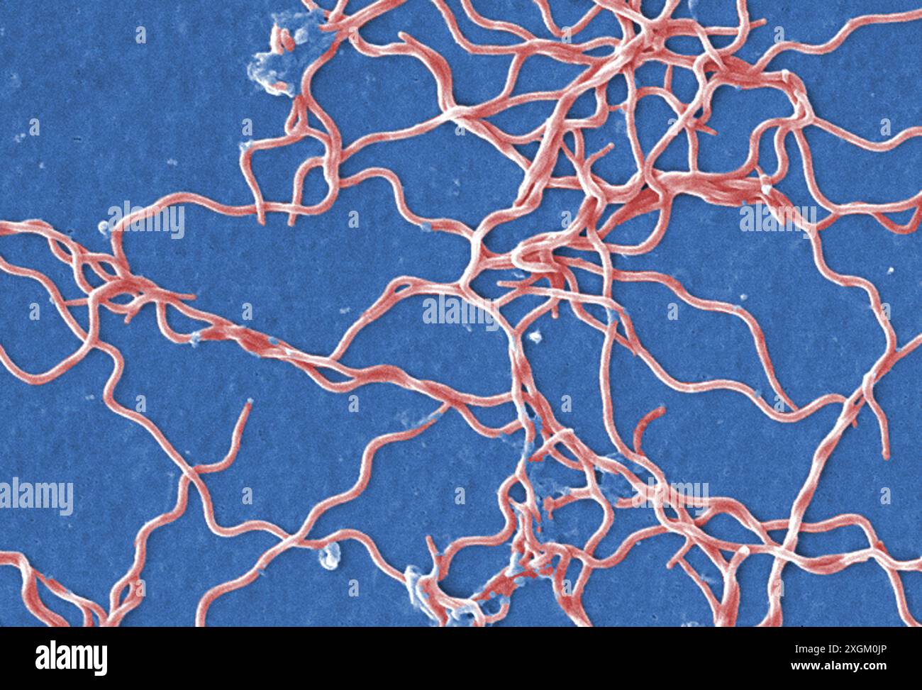 Coloured scanning electron micrograph (SEM) of a group of the bacteria ...