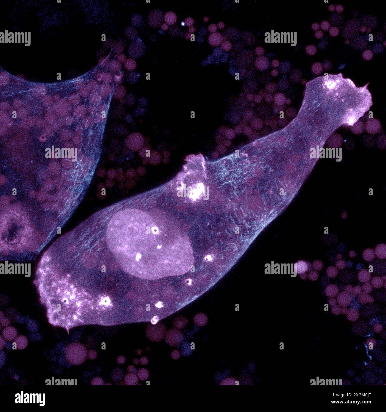 Confocal light micrograph of macrophage cells (purple) patrolling ...
