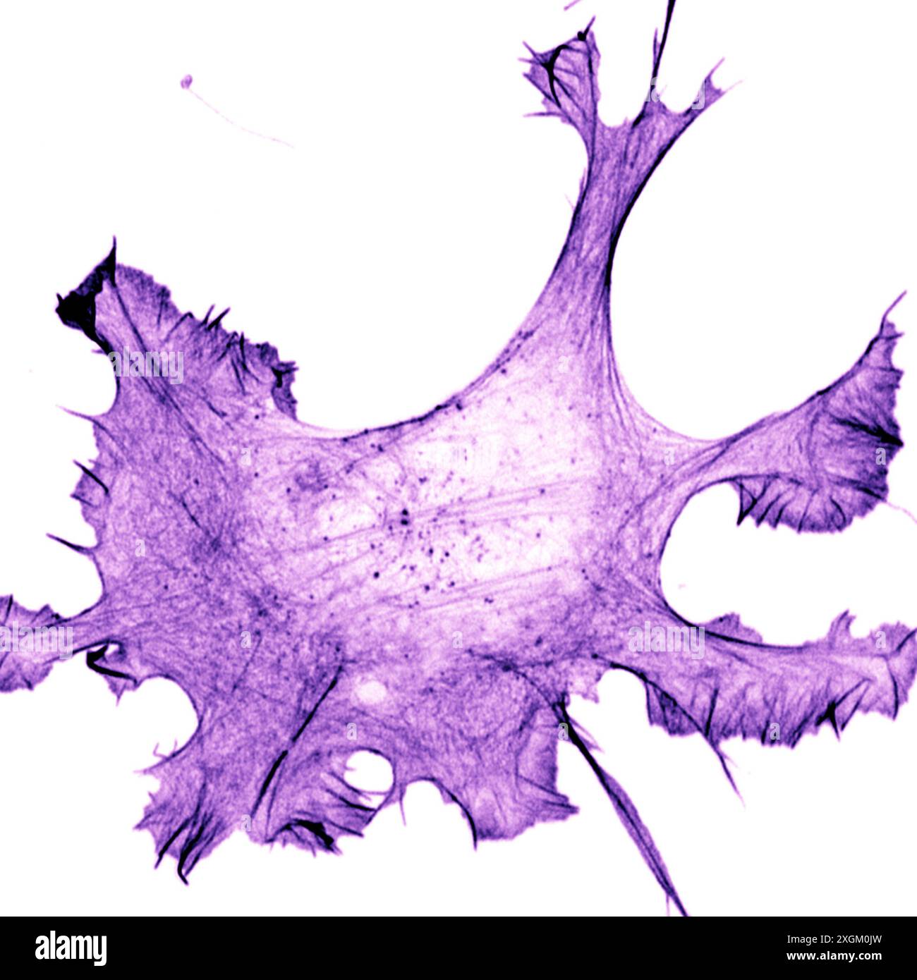 Migrating Ewing sarcoma cancer cell, confocal light micrograph. A ...