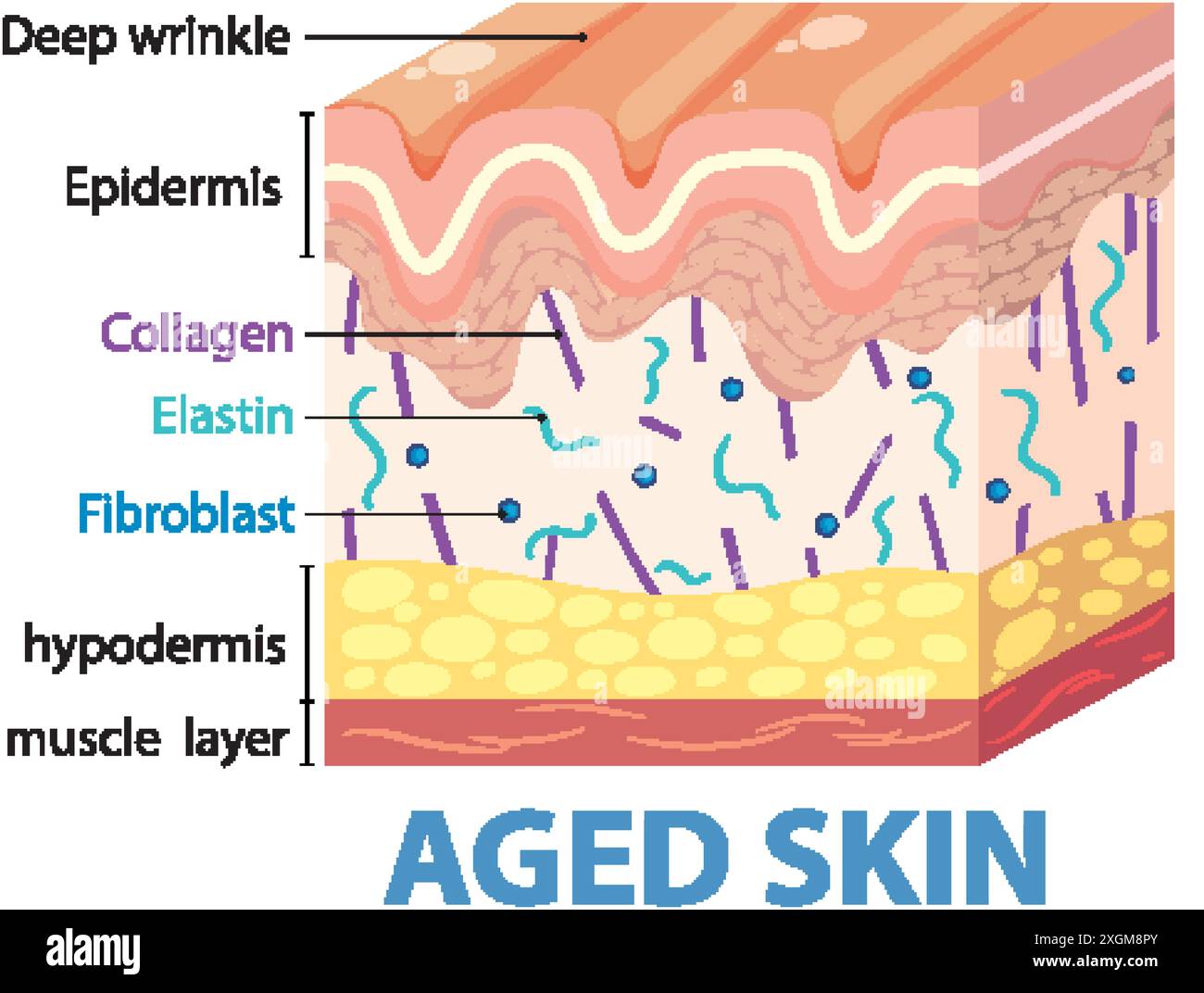 Illustration showing layers and components of aged skin Stock Vector ... Illustration showing layers and components of aged skin Stock Vector ...