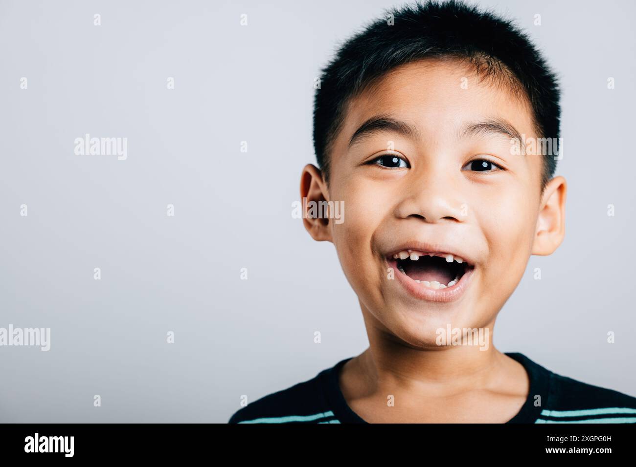 Smiling toddler with lost upper tooth dental gap shown. Child isolated ...