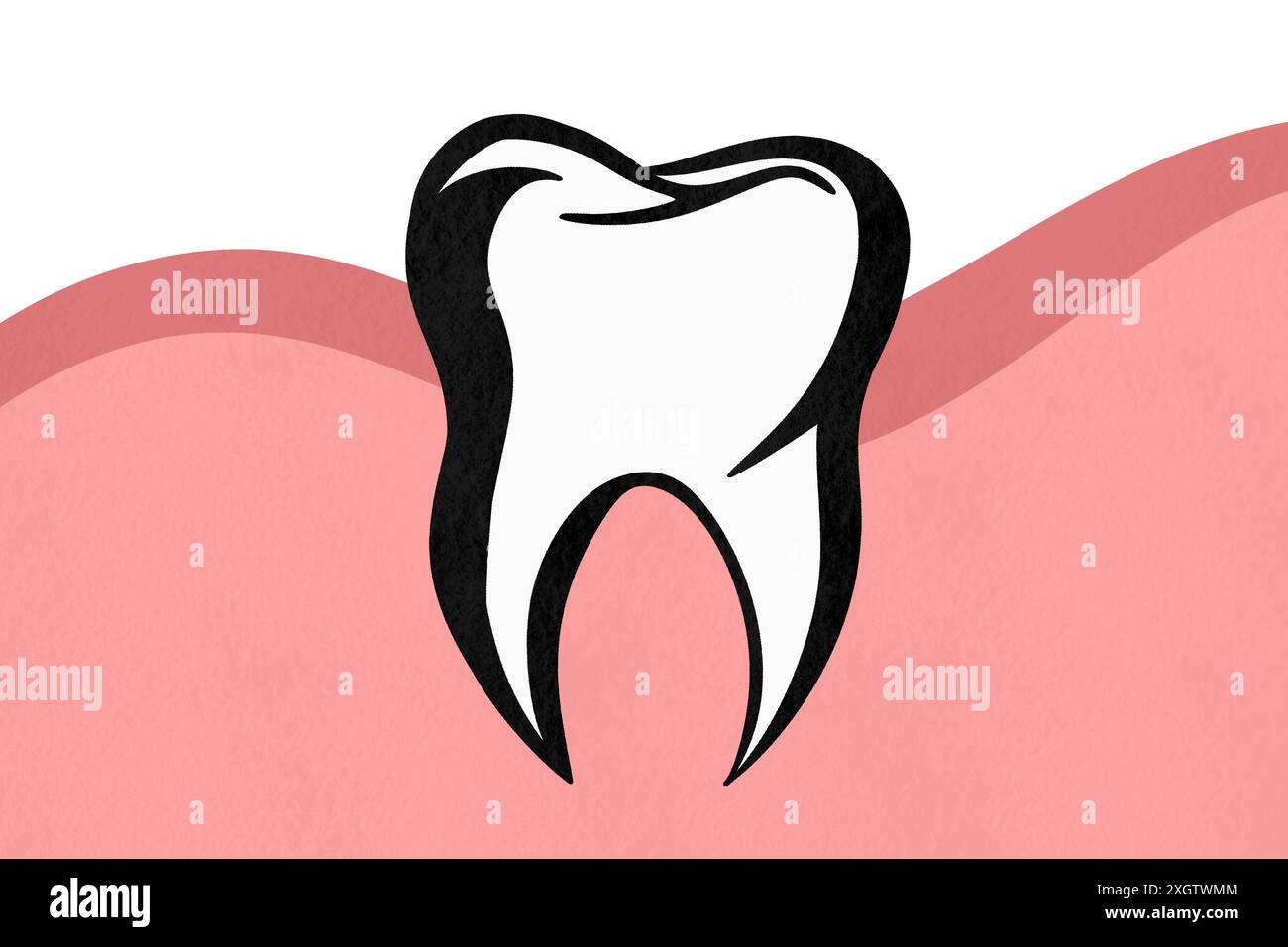 A graphic design portraying a bold black silhouette of a single tooth ...