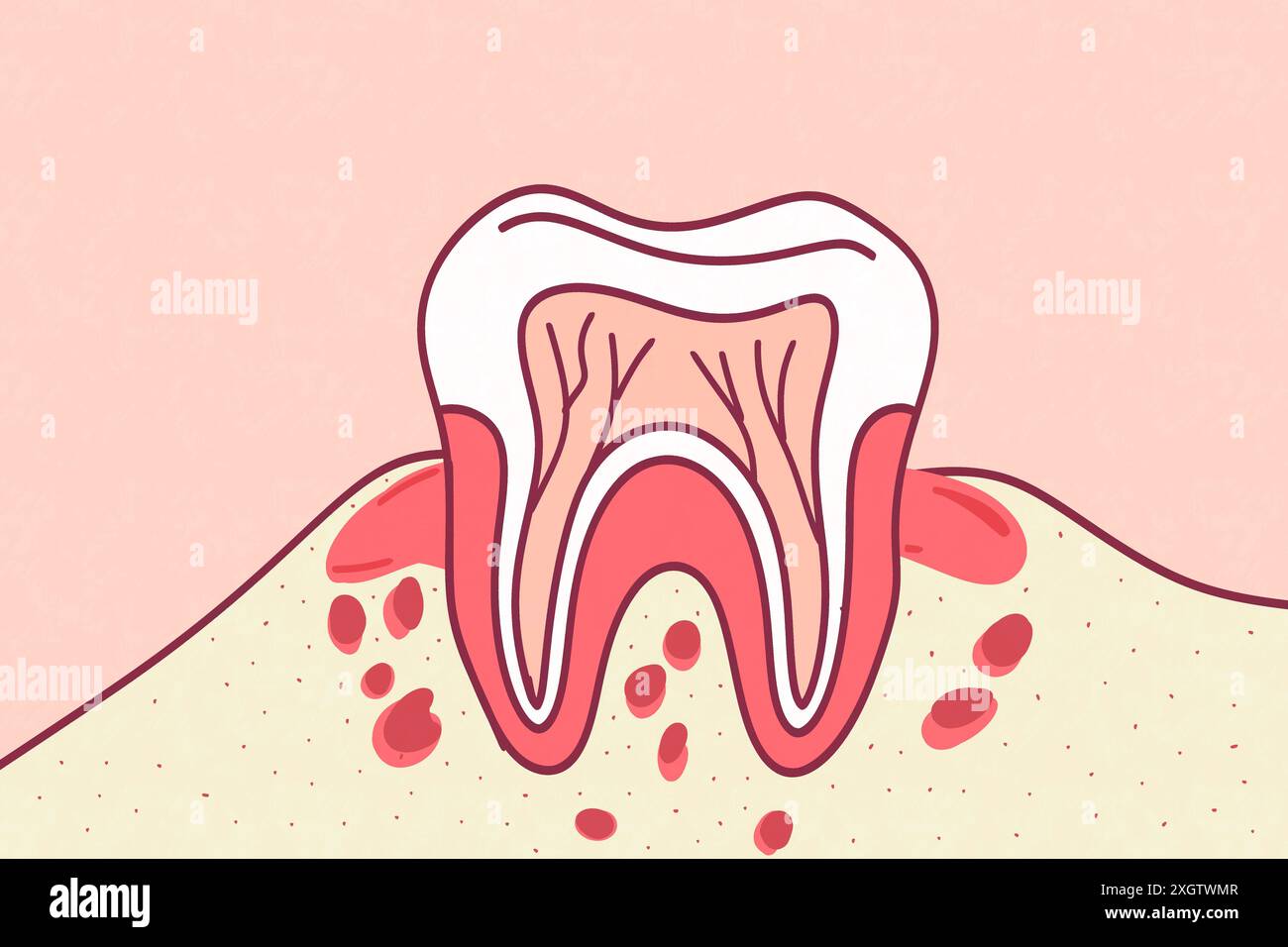 Molar tooth cross section hi-res stock photography and images - Alamy