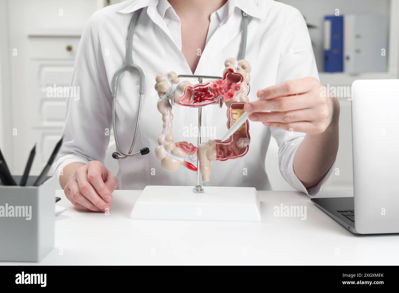 Digestive system in female anatomy hi-res stock photography and images ...