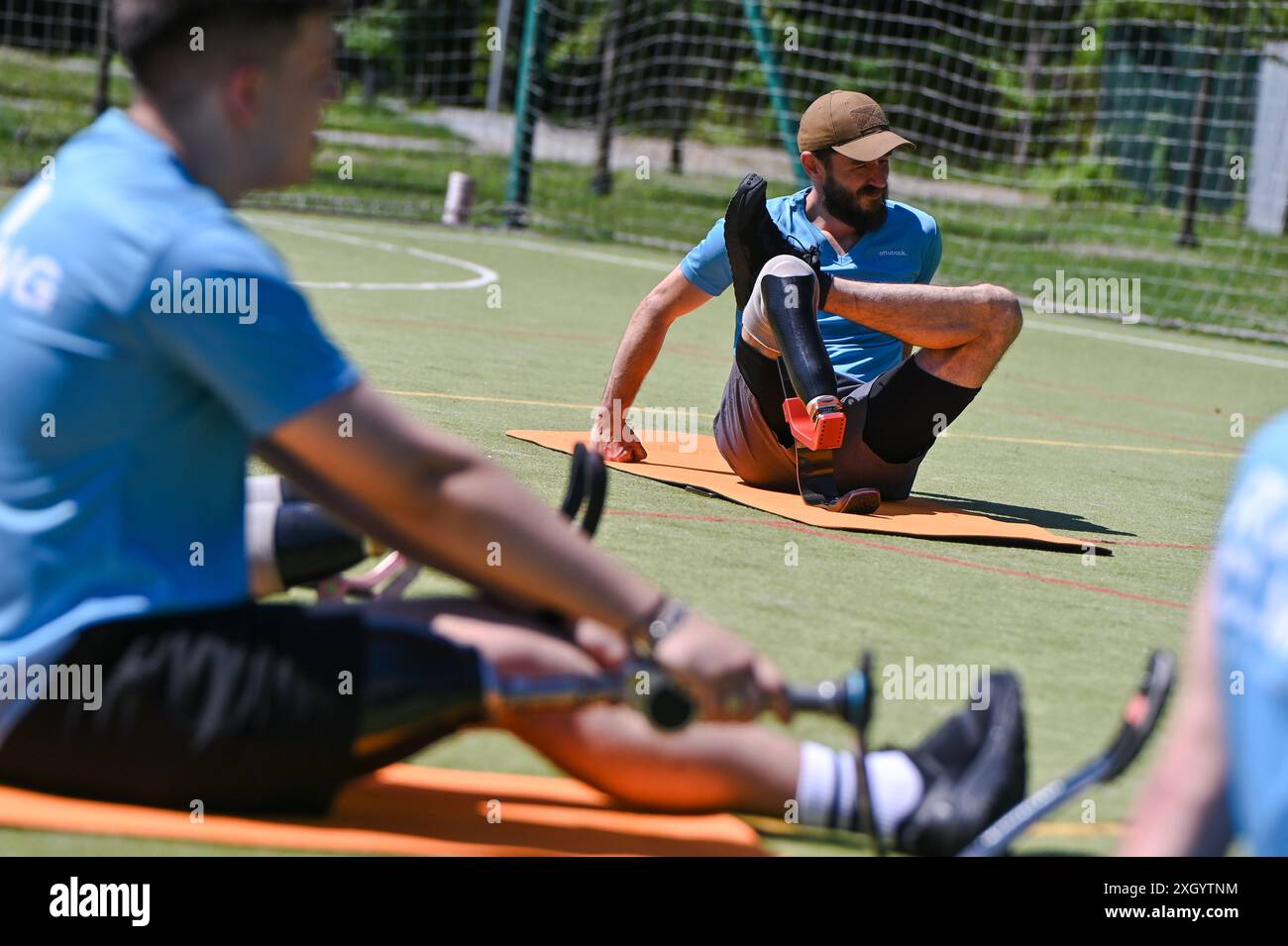 LVIV, UKRAINE - JULY 6, 2024 - A patient of the Superhumans Center ...