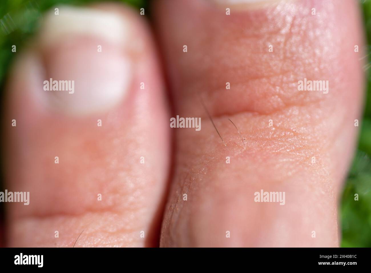Black toe hairs coming out of the skin in detail Stock Photo - Alamy