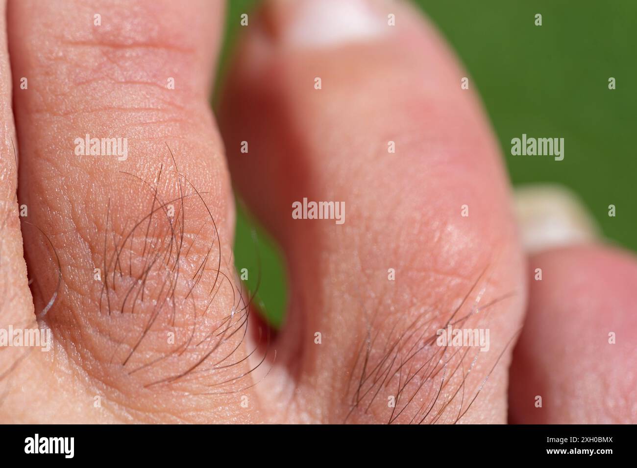 Black toe hairs coming out of the skin in detail Stock Photo - Alamy