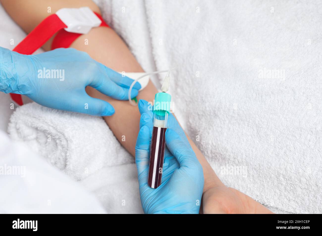 The blood tube is removed to the medical centrifuge for plasma lifting ...
