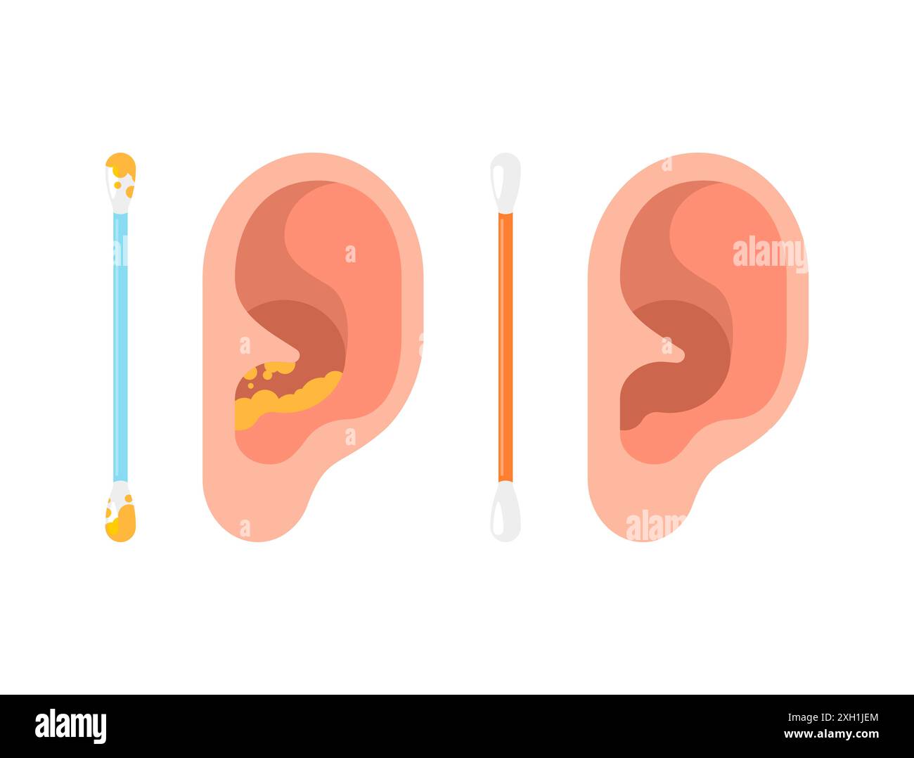 Human ear and ear stick. Ear cleaning stick Stock Vector Image & Art ...