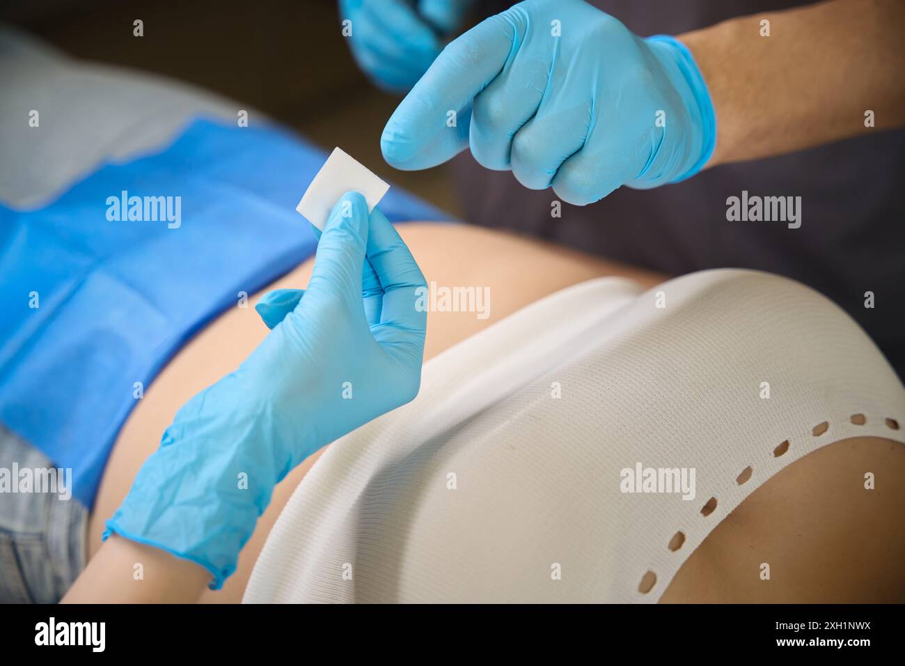 Dermatologic procedure hi-res stock photography and images - Alamy